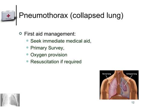 First Aid For Chest Injury Ppt