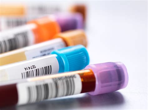 CH Complement Total Test SPL