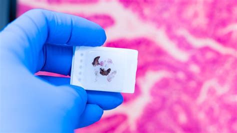 Ensure High Quality Nucleic Acids Analysis From Ffpe Samples Technology Networks