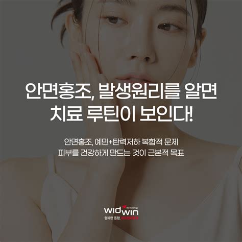 안면홍조 발생원리를 알면 치료 루틴이 보인다 압구정 위드윈 피부