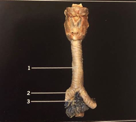 86 Tracheobronchial Lymph Nodes Diagram Quizlet