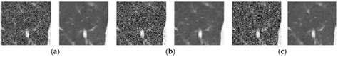 A Method Noise Based Convolutional Neural Network Technique For CT