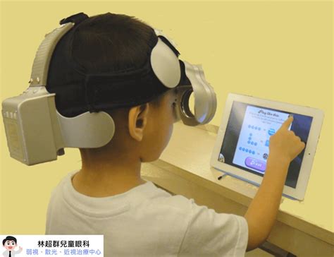 林超群兒童眼科 兒童散光大多屬天生遺傳性散光，但兒童的視覺系統，從出生到七歲這中間都還在發育，若是先天性散光較為嚴重者，有可能會因為呈像