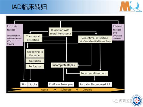 颅内动脉夹层的高分辨率磁共振血管壁成像 脑医汇