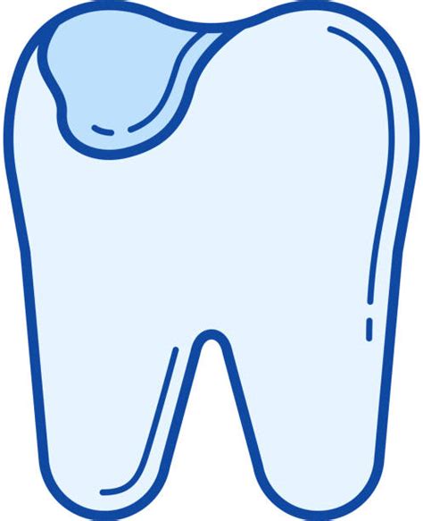 Royalty Free Endodontics Clip Art Vector Images And Illustrations Istock