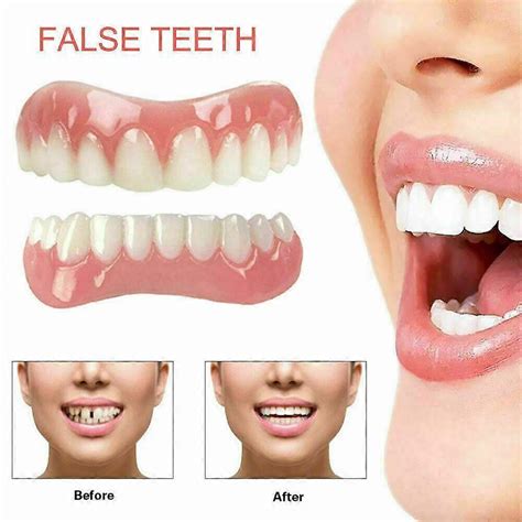 Veneers False Teeth Snap On Instant Smile Veneers Cosmetic Teeth Dentures Dental AwB BFR Fruugo UK