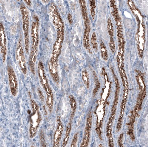 Mouse Monoclonal Anti Muc1 Antibody Buy For Research Highly