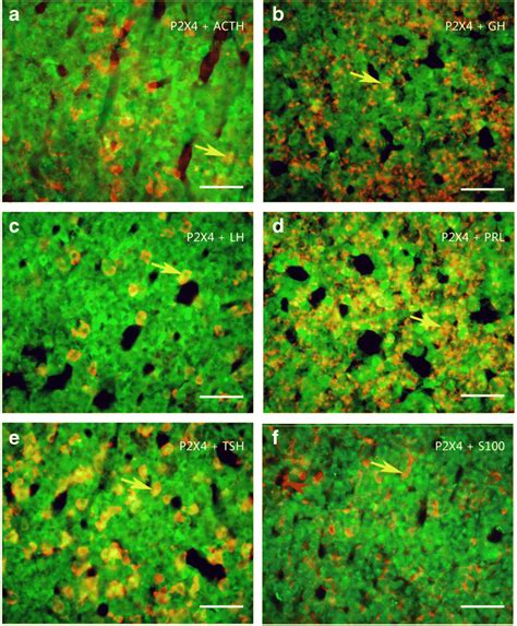 Colocalization Of P2X4 Receptor Ir Green With ACTH Ir LH Ir TSH Ir