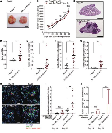 Fbxw7 Deletion In Bm Promotes Cancer Metastasis In An Orthotopic Breast