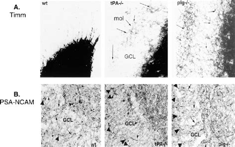 Structure Of Dentate Gyrus Semantic Scholar