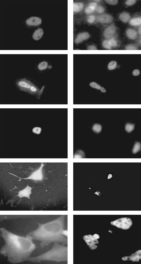 Cell Localization Of The Methylldnaabinding Protein Kaiso A B