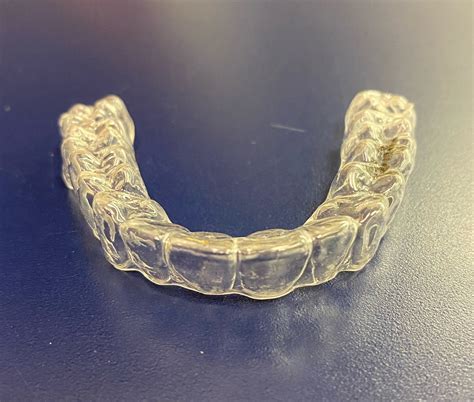 Eric Heim Dental — Clear Aligner Orthodontics