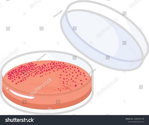 Isolation Gramnegative Bacteria On Macconkey Agar Stock Vector Royalty