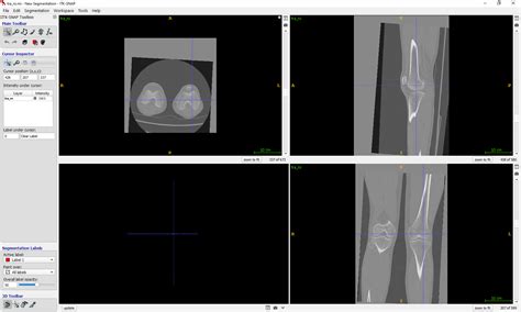 How To Resample Sitk Image To A New Spacing Issue SimpleITK SimpleITK GitHub