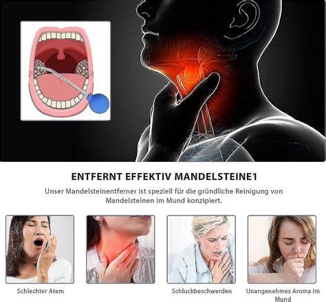 Tonsil Stone Remover Tonsil Stone Removal Tool Tonsil Stone