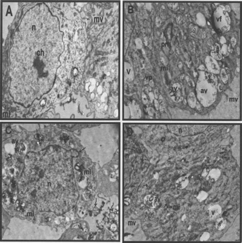 Transmission Electron Microscopy Tem View Of C6 Glioma Spheroids At