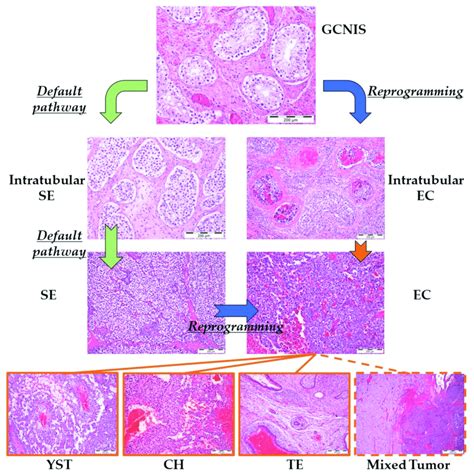 Testicular Cancer Etiology Distribution Of The Patients Regarding The Etiology Of