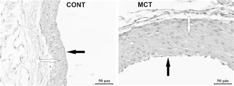 Representative Photomicrographs Of A Histological Transverse Section Of