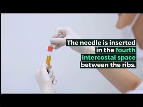 Injection Intracardiaque