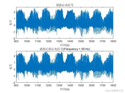 【心电信号ecg】基于matlab Ecg心电信号心率变异性（处理原始数据、识别心跳、计算rr间隔并分析）【含matlab源码 10921期