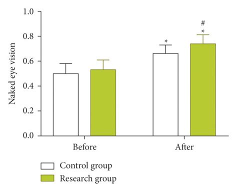 Retracted Effect Of Atropine Eye Drops Combined With Vr‐based Binocular Visual Function