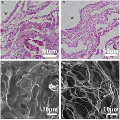 A He Image Of Sis Without Decellularization Showing Many Blue