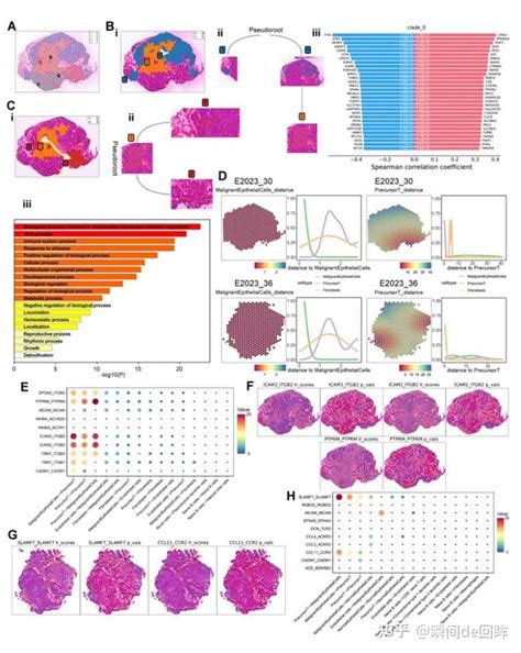 【中科院1区12 4】空间代谢 空间转录组｜高pd 1表达和治疗反应鼻咽癌中的代谢重编程和细胞相互作用 知乎