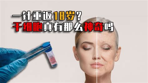 一针重返18岁？干细胞到底是什么？多位明星使用后效果令人惊叹！腾讯视频