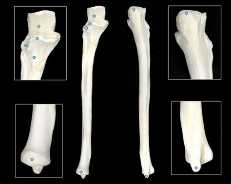 Ulna Anterior And Posterior Views Diagram Quizlet