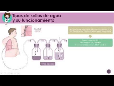 Drenaje Pleural Sello De Agua Youtube