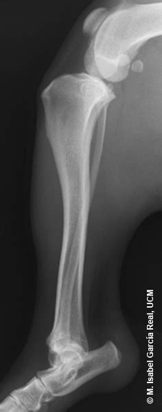 Tibia Fibula Mediolateral View