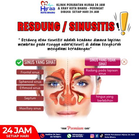 Klinik Rawatan Untuk Sinus Resdung 🤧 🔬 Antara Rawatan Sinus