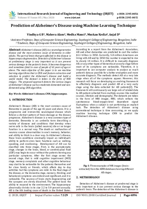 Pdf Irjet Prediction Of Alzheimers Disease Using Machine Learning