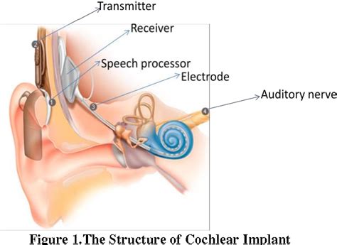 Figure 1 From Vlsi Architecture Of Digital Auditory Filter For Speech