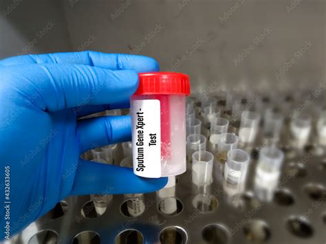 Sputum Collection