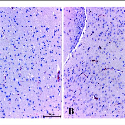 Histopathology Of Toxoplasmic Encephalitis Stained By Haematoxylin And