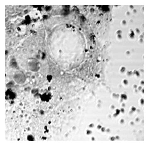 Localization Of Crystalline Anatase And Rutile Tio2 Nps In Hepg2 Cells Download High