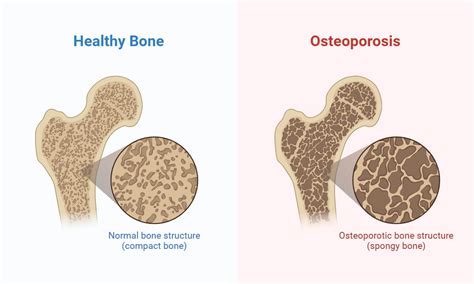 Bone Cells Types Structure Examples Functions