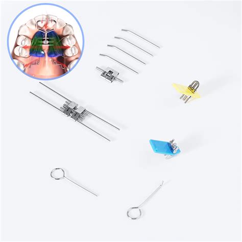 牙科正畸螺旋扩弓器普通型支架型正畸矫正扩弓器口腔西湖巴尔材料虎窝淘