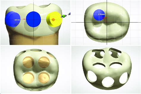 Porous Frame Design Process Three Holes In Each Of The Buccal And Download Scientific Diagram