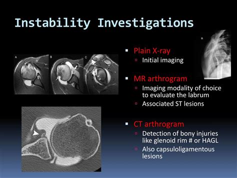 Ppt Common Painful Shoulder Conditions Powerpoint Presentation Free