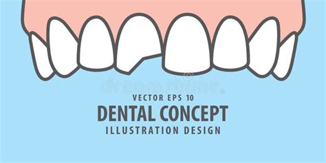 Banner Upper Chipped Tooth Illustration Vector On Blue Background