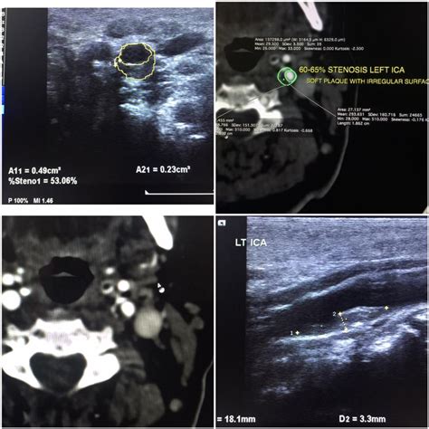 Proscan Diagnostics Mumbai