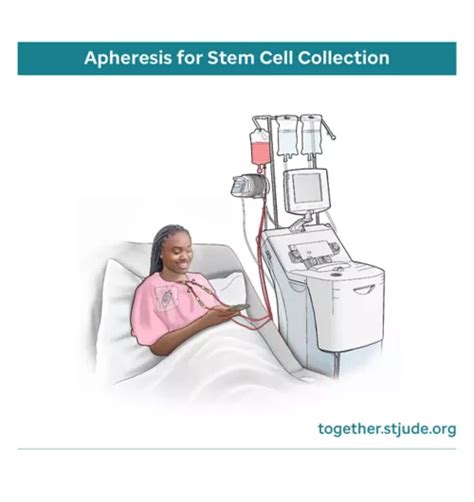 Apheresis For Stem Cell Collection Together By St Jude™