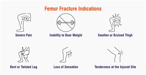 Femur Fractures Types Causes Symptoms Diagnosis And Treatment Guide