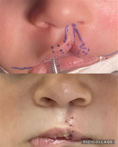 Mohammed Akef Aldabbas Dr Mohammed Akef • Instagram Photos And Videos