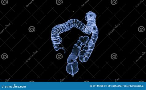 Ct Colonography Or Ct Scan Of Colon 3d Rendering Image For Screening Colorectal Cancer Check Up