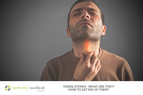 Tonsil Stones What They Are And How To Get Rid Of Them Medical