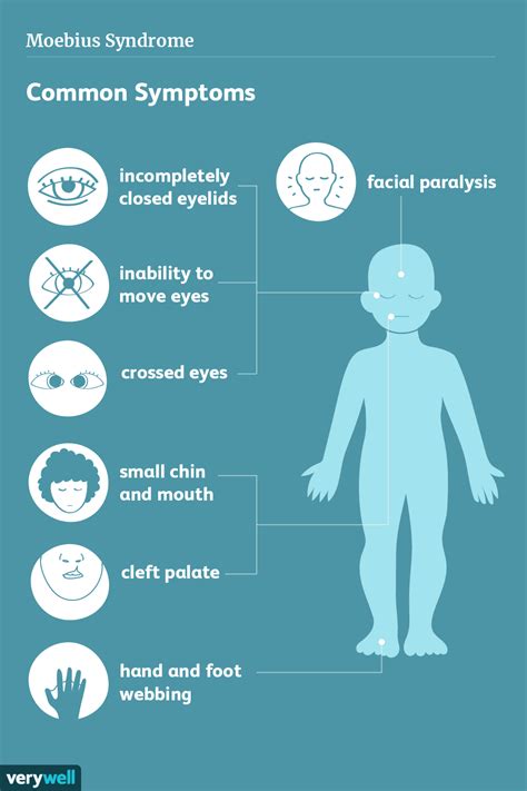 Moebius Syndrome Symptoms Diagnosis And Treatment