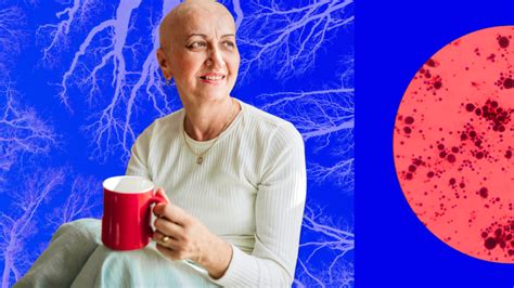 Where Can Lung Cancer Spread Common Areas For Metastastis